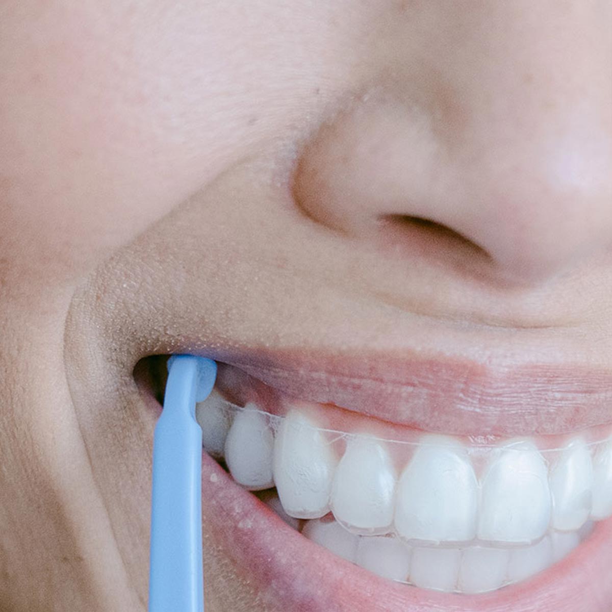 Accessories – Invisalign USA Store