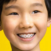 PUL® System - 1 pack | Invisalign Accessory Store